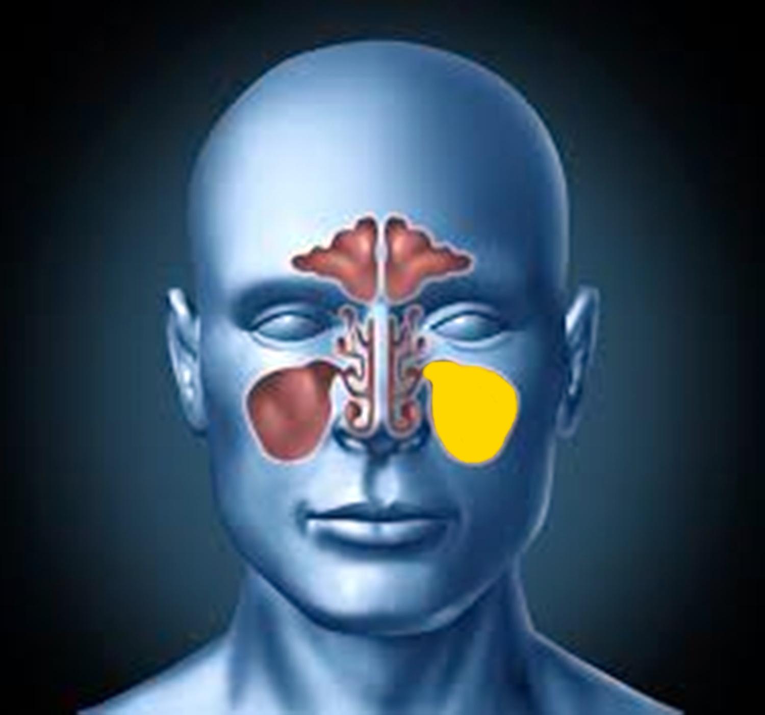 Health Zone Turkey: Endoscopic Sinus Surgery