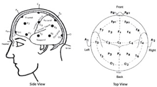 Intermediate Physics for Medicine and Biology: The 10-20 System