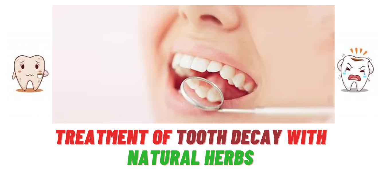 Treatment of tooth decay with natural herbs