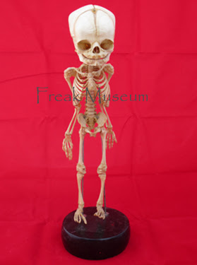 Freak Museum A Private Collection: Man is...