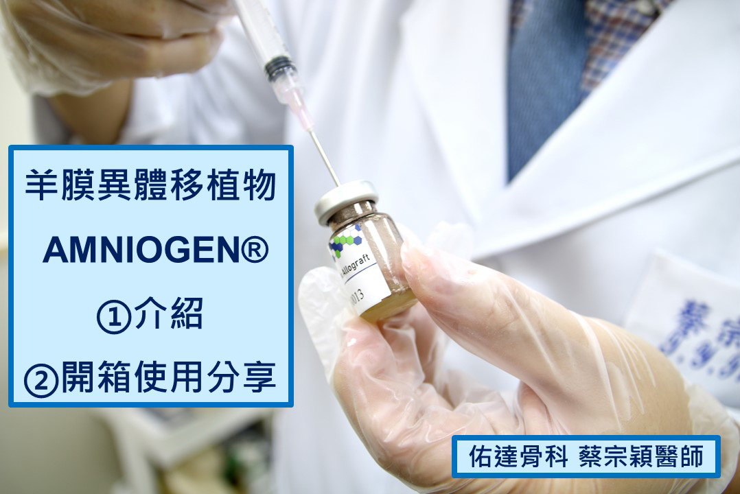 蔡宗穎 醫師 │ 骨科 疼痛 增生注射 脊椎骨盆平衡矯正 脊椎熱凝雷射 : 羊膜異體移植物 AMNIOGEN® 介紹 & 開箱使用分享
