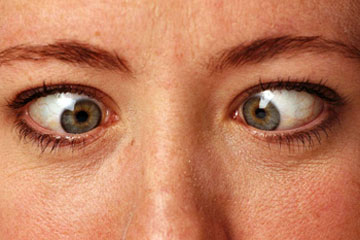 KuceKece: Mata Berkantung? Ini Cara Menghilangkannya