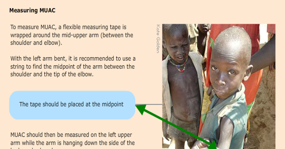 community medicine: SOP - mid upper arm circumference (MUAC)