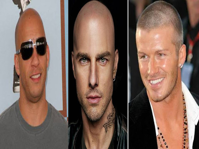 Blog Das Moraes: Dicas para os Carecas