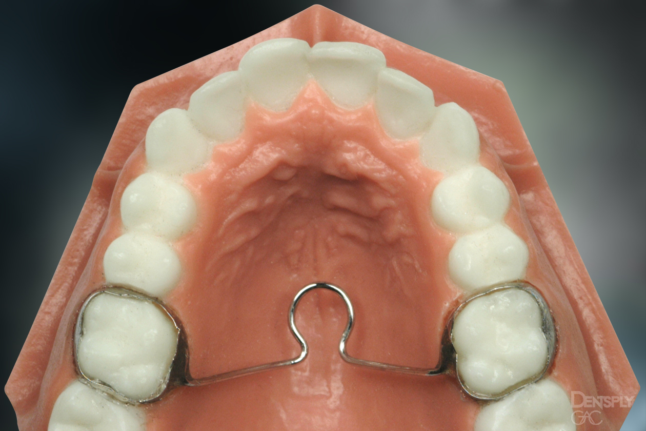 James R. Waters, DDS, MSD, PA: Why are Holding Arches important?