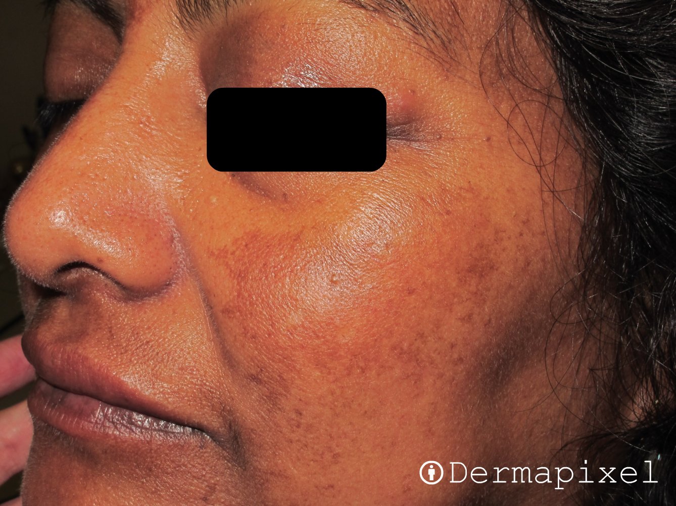 Dermapixel: octubre 2011