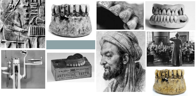 Historical milestones in dentistry