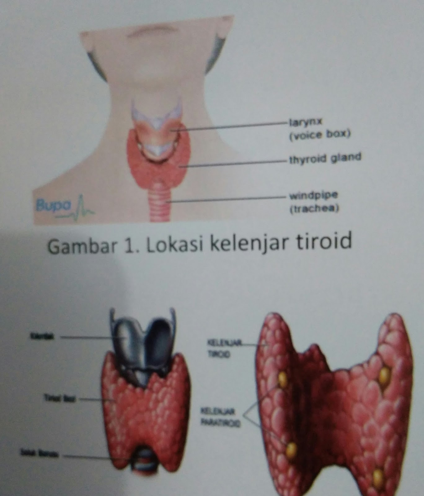Waspada Gangguan Tiroid "Kenali Gejala Awal Periksakan Dan Berobat Segera".