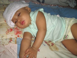 Obat Manjur Sekitar Kita: Mengobati Campak (Gabaken) Dengan Jagung Muda ...