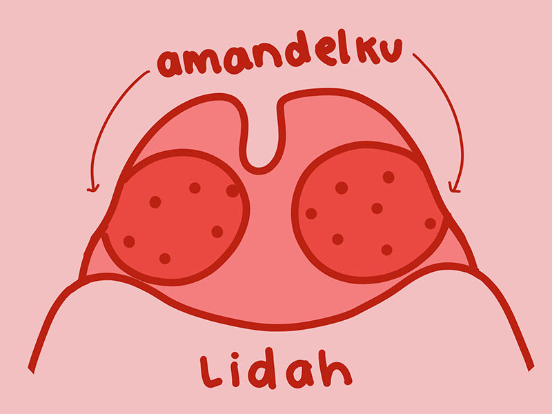 Akhirnya Operasi Amandel | annisast.com | Parenting Blogger Indonesia