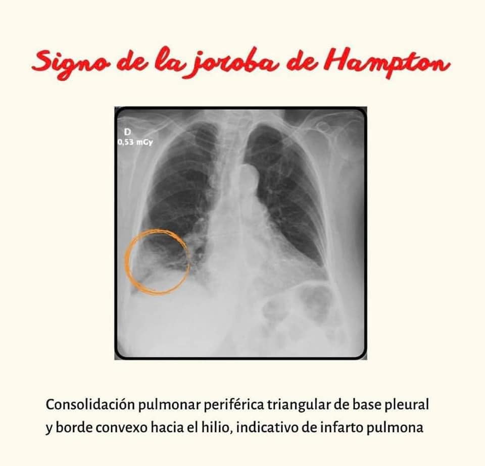 ZONA DE SALUD DE OFRA: Urgenciologos, residentes de urgencias y afines ...