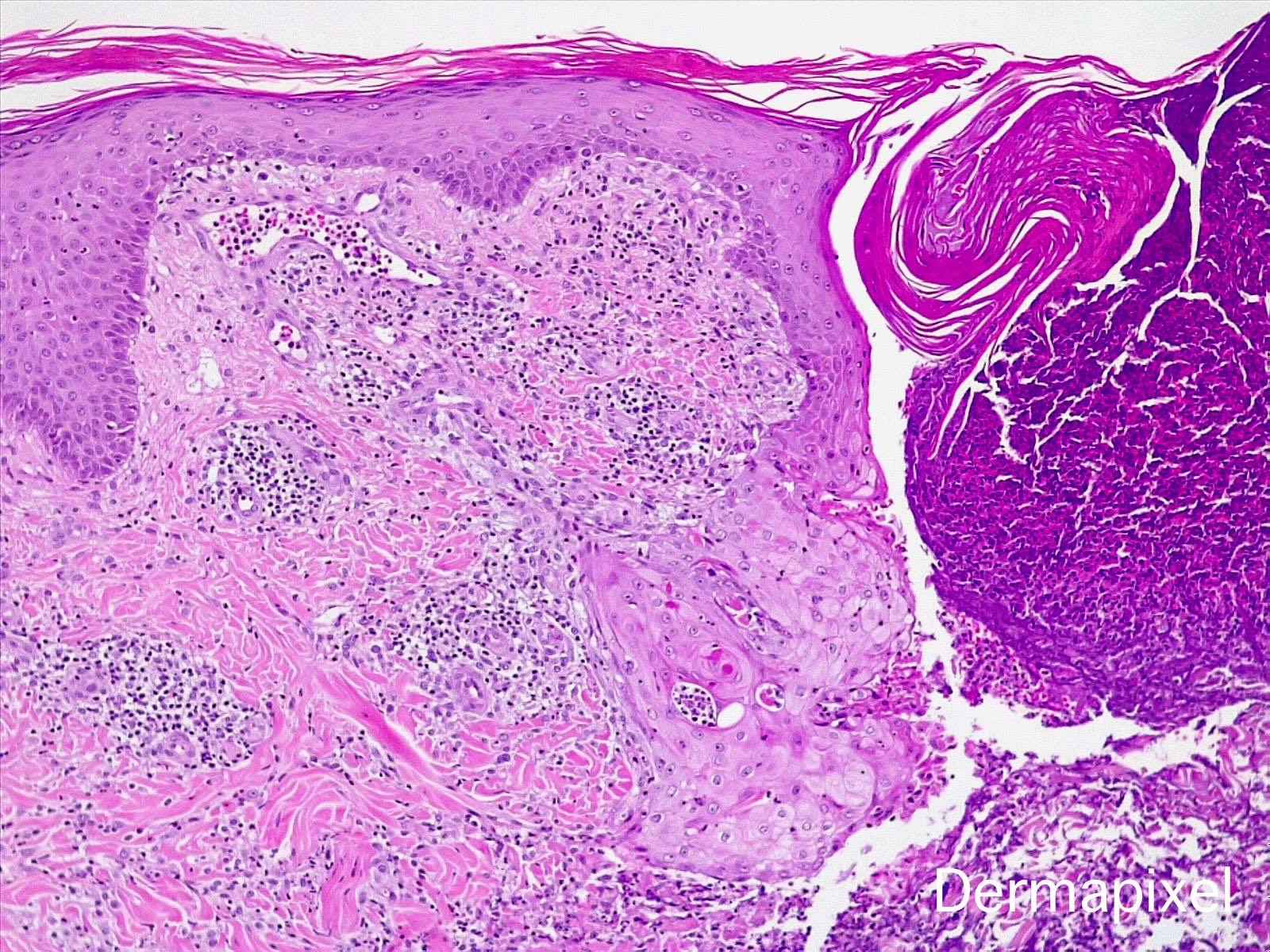 Dermapixel: abril 2020