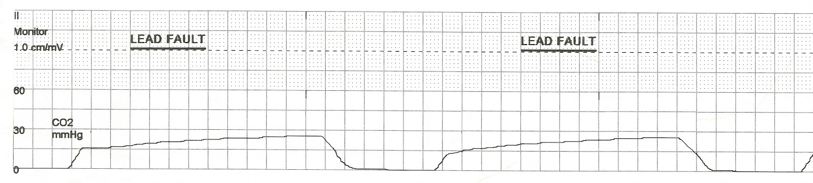 Pediatric PEA Part 3