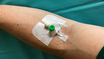 20+ IV Therapy Tips and Tricks : Improve Cannulation Skills - Nurses ...