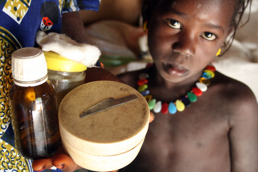 DAOUBAKARYEMMANUEL: E! comme Excision