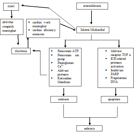 Infark Miokard Akut (AMI) ~ Informasi Kedokteran Dan Kesehatan