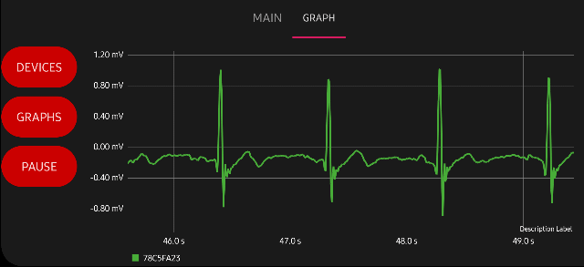Muscle Oxygen Training: Polar H10 ECG tracing - a short how to guide