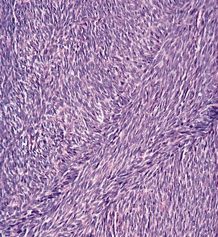 Pathology Mcqs Postgraduation Entrance preparation