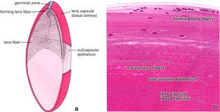 Dokter Umum: Katarak Kongenital