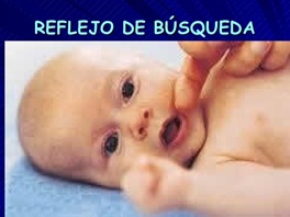 REFLEJOS DEL RECIEN NACIDO ~ Fisioterapia