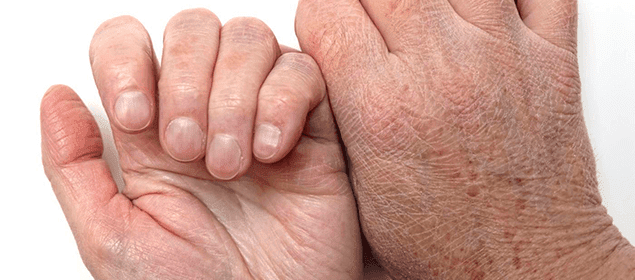 Remedios caseros para reparar la piel áspera y reseca