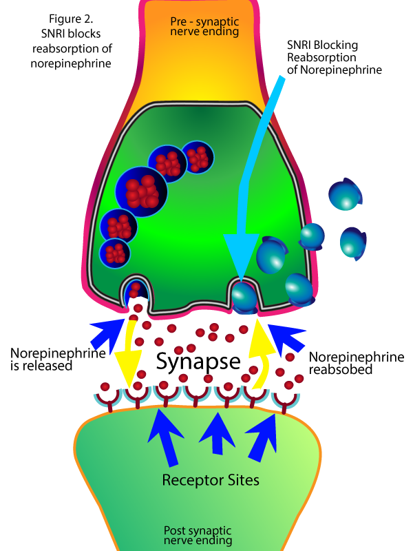 THE PSYCH KIT: PSYCHOLOGICAL DISORDERS - DEPRESSION