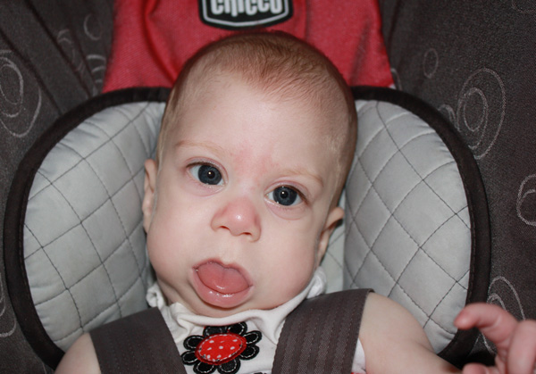 SÍNDROMES GENÉTICOS EN EL PERIODO NEONATAL: CLASIFICACIÓN CLÍNICA