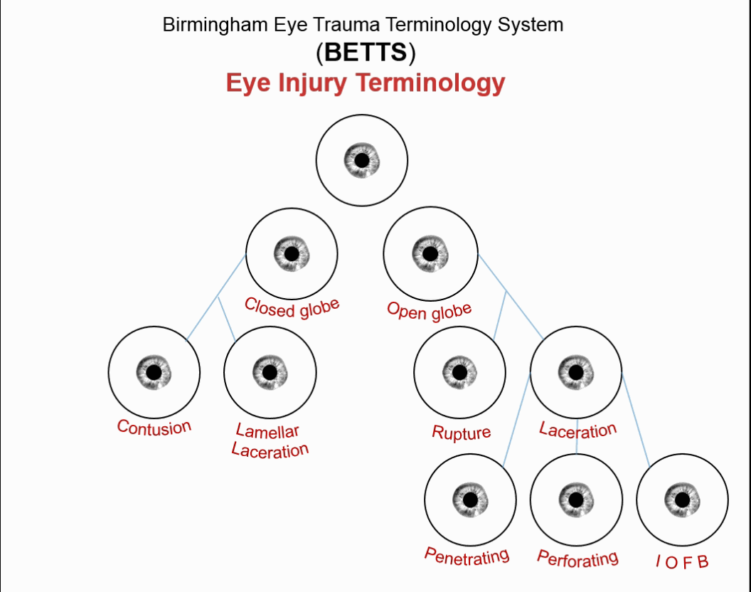Ophthalmology Notes: Birmingham Eye Trauma Terminology (BETT)
