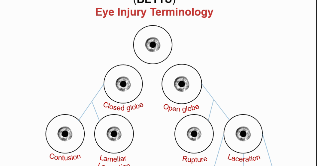 Ophthalmology Notes: Birmingham Eye Trauma Terminology (BETT)