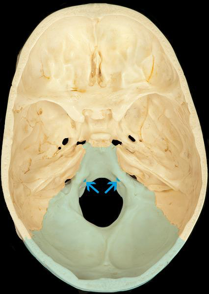 Asymmetry of the Modern Human Endocranium: Placing the fixed landmarks ...