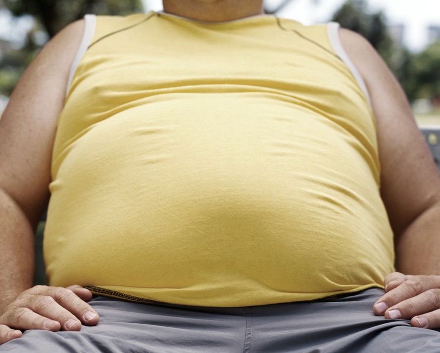 How to Overcome Obesity | My Cyber Station