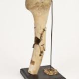 The Pain of Gunshot Wounds ~ Civil War Rx