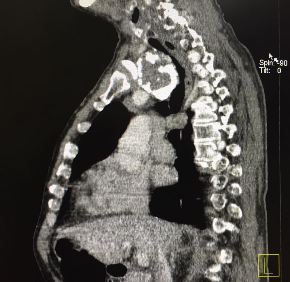 EL RINCÓN DE LA MEDICINA INTERNA. juanpedromacaluso@yahoo.com.ar ...