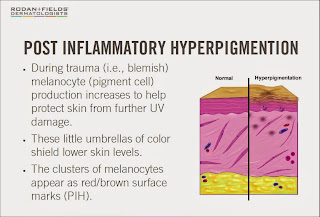 ageless beauty, timeless skin: Post-inflammatory hyperpigmentation: Q & As