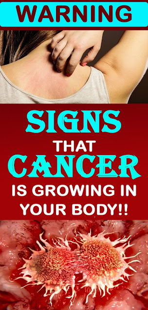 16 Early Warning Signs Of Cancer In Your Body Should Not Ignore ...