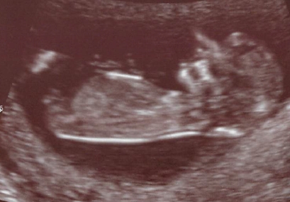 Life and Love in the Petri Dish: watch Mo and Will's baby grow!!