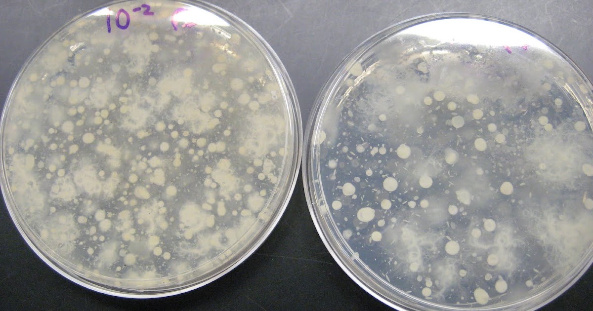 DVC Microbiology 146 Fall 11 (Gard): Lab 41: Standard Plate Count of ...