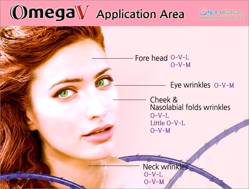 Only Medical 온리메디칼: Only Medical PDO Thread lifting product : Omega V ...