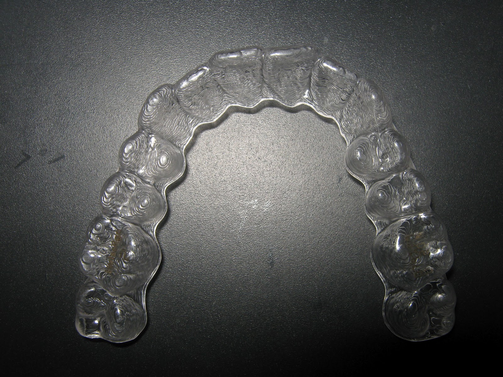 Br@ndy's Invisalign Journey: Tray 20!