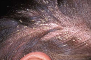 Lecture Notes in Medical Technology: Lecture #16: INTRODUCTION TO MYCOLOGY