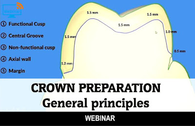 CROWN PREPARATION: General principles