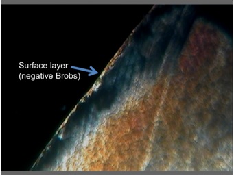 Polarizing microscopy of dental enamel and caries histopathology ...