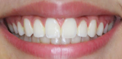 5 Best and Basic Ways to Use Coconut Oil - Safayk