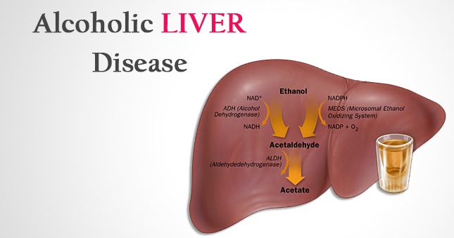 Alcoholic Liver Disease