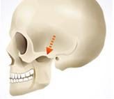 Eyelid Surgery Legend Dr. Kim Byung Gun: [BK Plastic Surgery Hosptial ...