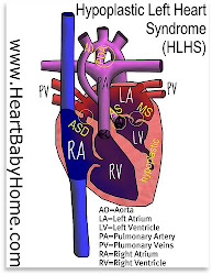 Green Eggs & Hamiltons...: CHD Awareness Poems