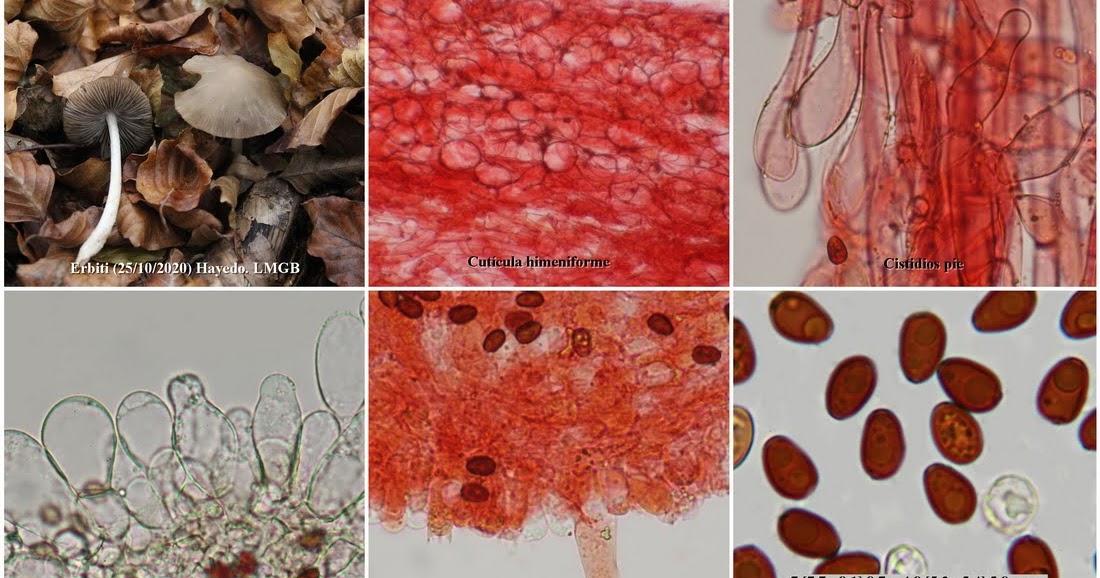 Microscopía de hongos. Vol 4. O - R: Psathyrella spadiceogrisea