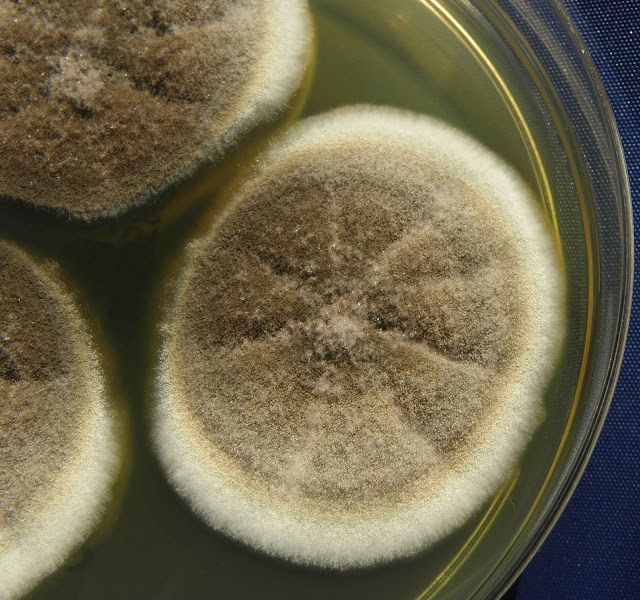 ATLAS MICOLOGIA: ASPERGILLUS USTUS COMPLEXO