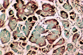 Shikata orcein stain(HbsAg)