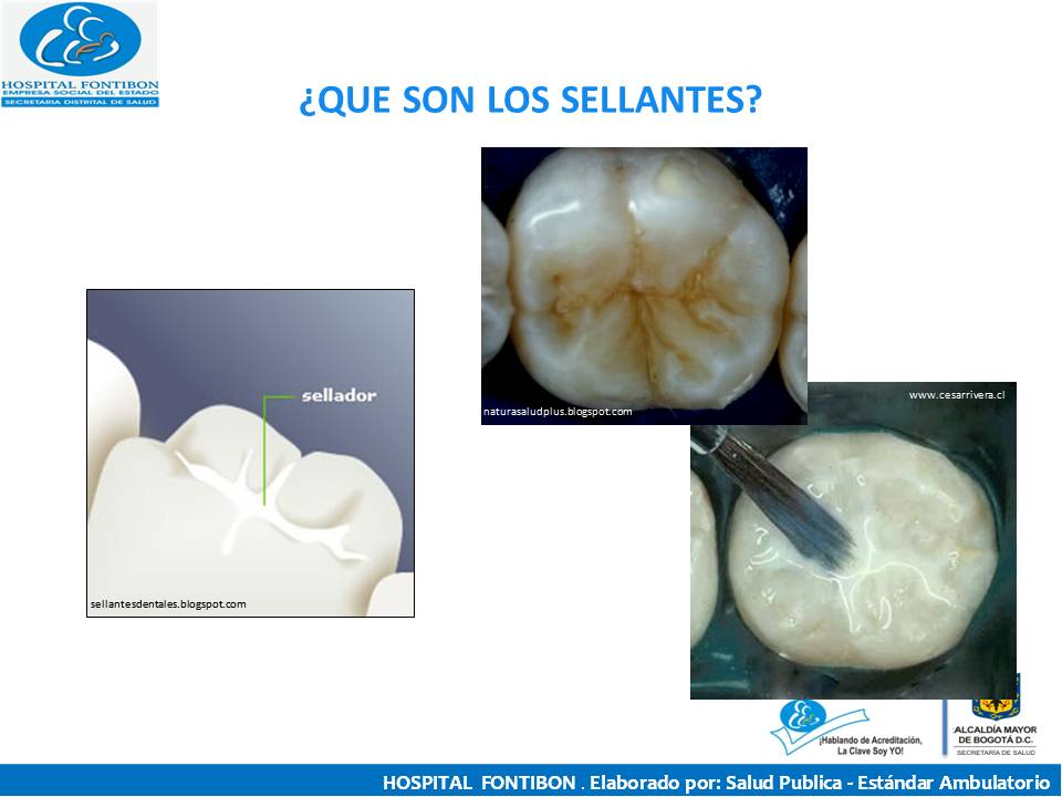 Ambito IPS: ROTAFOLIO DE SALUD ORAL